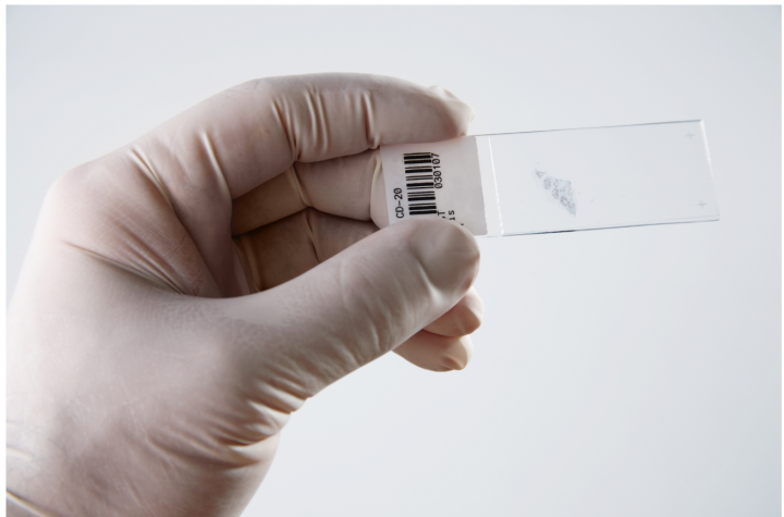 Digitizing anatomopathology: revolutionizing medical diagnosis – Blog i2S